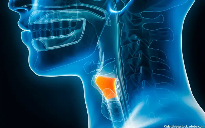 Laryngitis - Symptome, Diagnostik, Therapie | Gelbe Liste