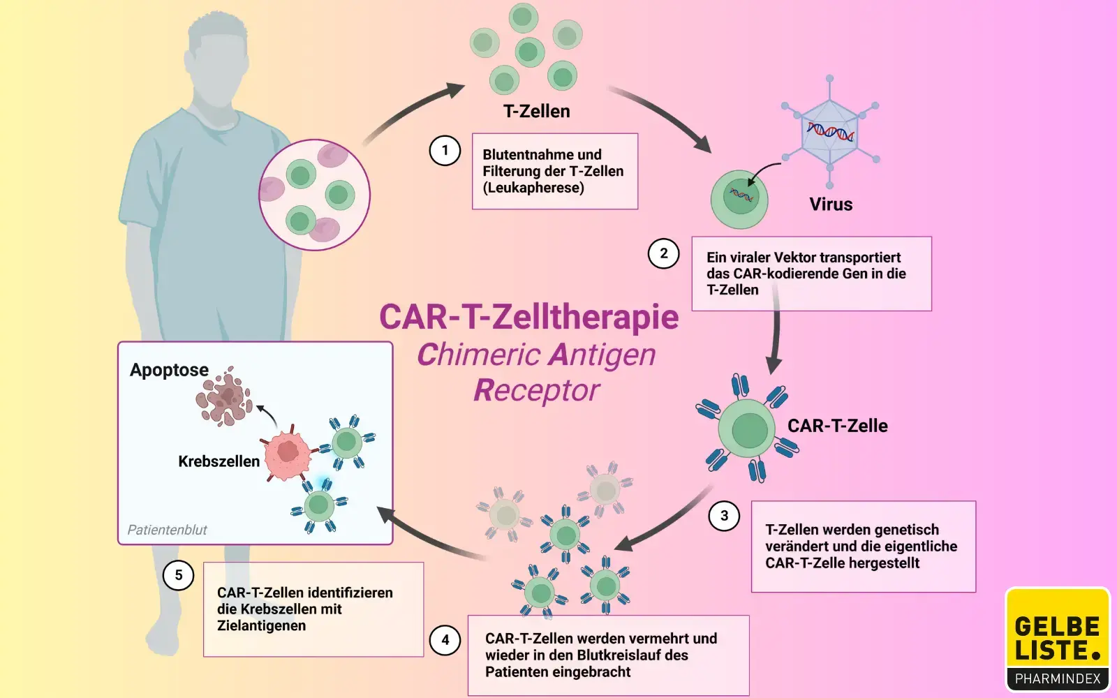 CAR-T-Zell-Therapeutika kompakt | Gelbe Liste